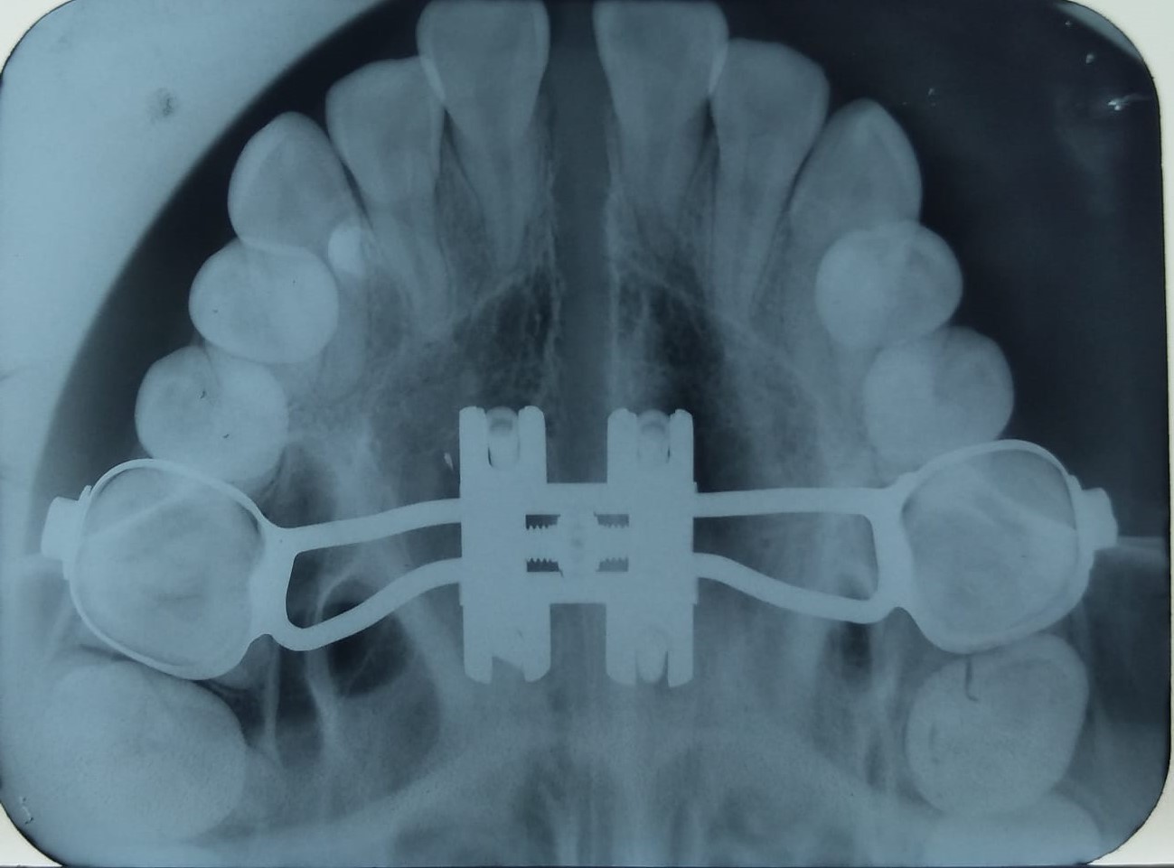 CURSOS DE ESPECIALIZACIÓN :: aeortodoncia